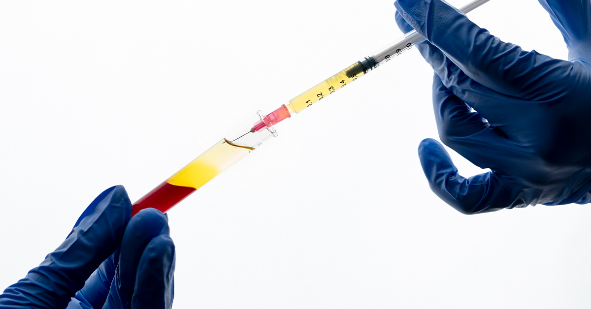 (PRP) Platelet-Rich Plasma Injections: How It Works and What It Costs